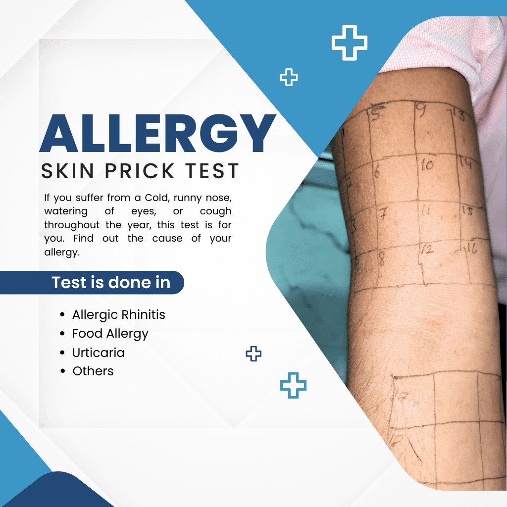 Allergy Test - Dr Sarthak Chakravarty